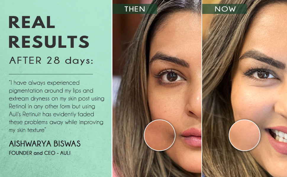 ANTI-AGEING RETINOL - RETINUIT | aulilifestylecom